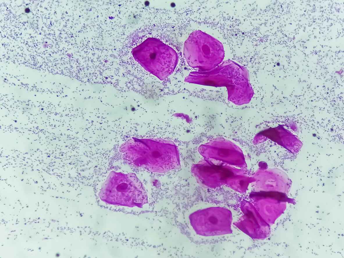 Can Men Get Bacterial Vaginosis (BV)